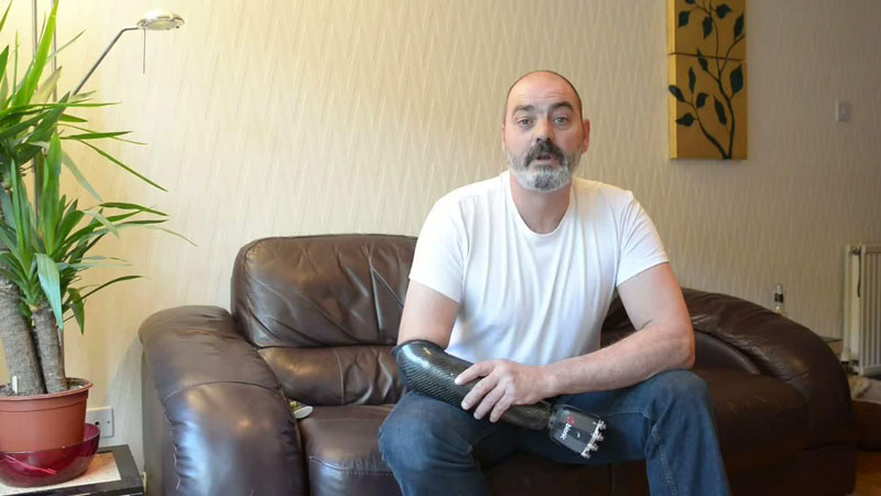'Terminator' Arm is World's Most Advanced Prosthetic - TwistedSifter