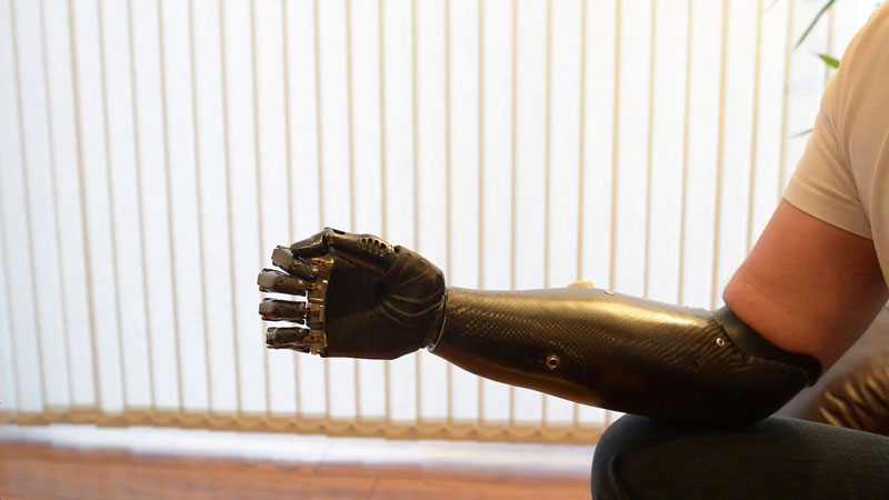 ‘Terminator’ Arm is World’s Most Advanced Prosthetic » TwistedSifter
