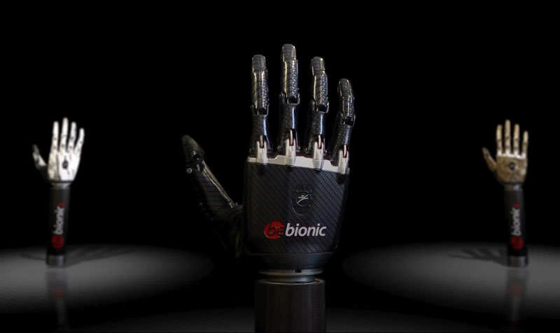 ‘Terminator’ Arm is World’s Most Advanced Prosthetic » TwistedSifter