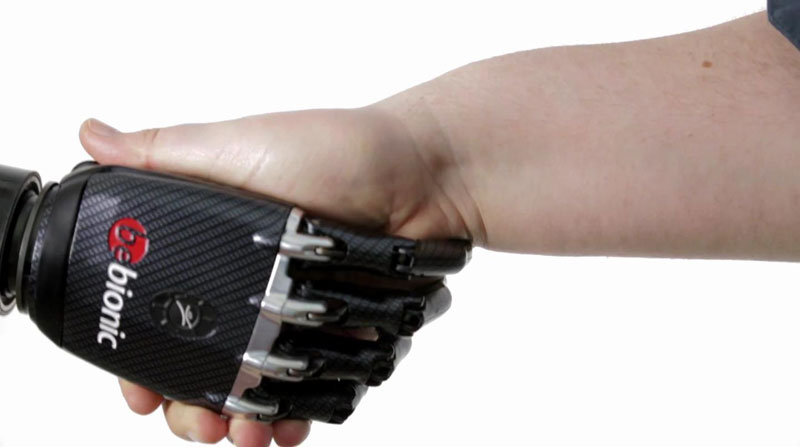 'Terminator' Arm is World's Most Advanced Prosthetic - TwistedSifter