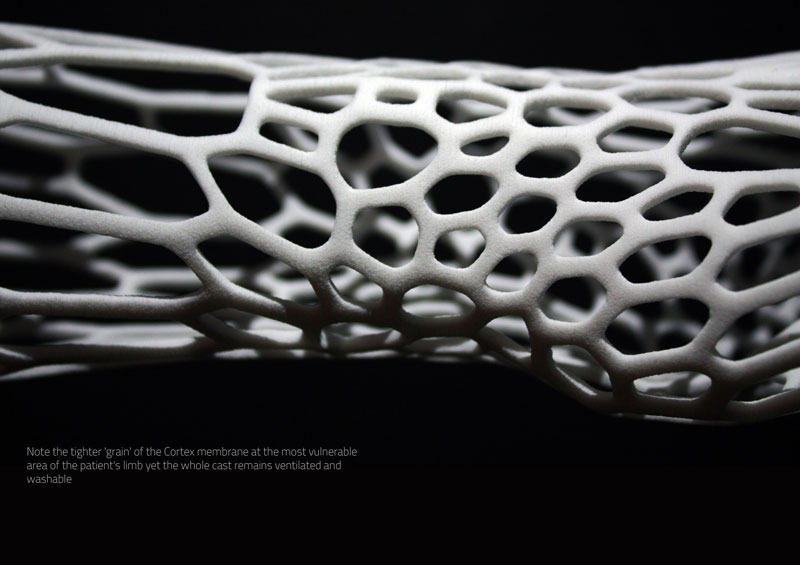 Could This Be the 3D-Printed Cast of the Future? » TwistedSifter