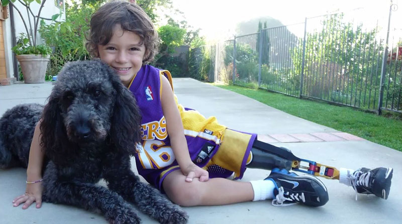 This 9-Year-Old Boy with One Leg and a 2-fingered Hand Will Inspire You ...