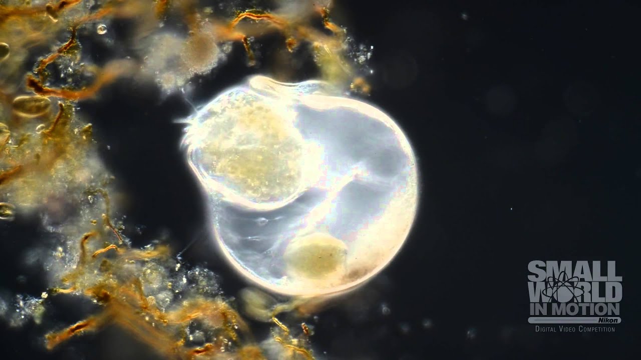 Award-Winning Video Captures Single Celled Organism Attacking Its Prey ...