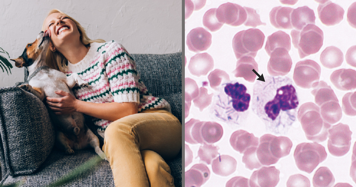 Why You Might Want To Say ‘No’ To A Slobbery Kiss From Your Pup ...