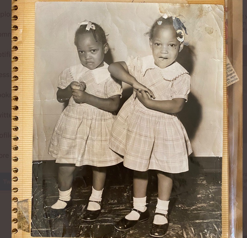 Separated in 1955, Conjoined Twins Talk About Life After Surgery ...