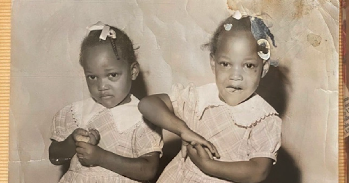 Separated in 1955, Conjoined Twins Talk About Life After Surgery ...