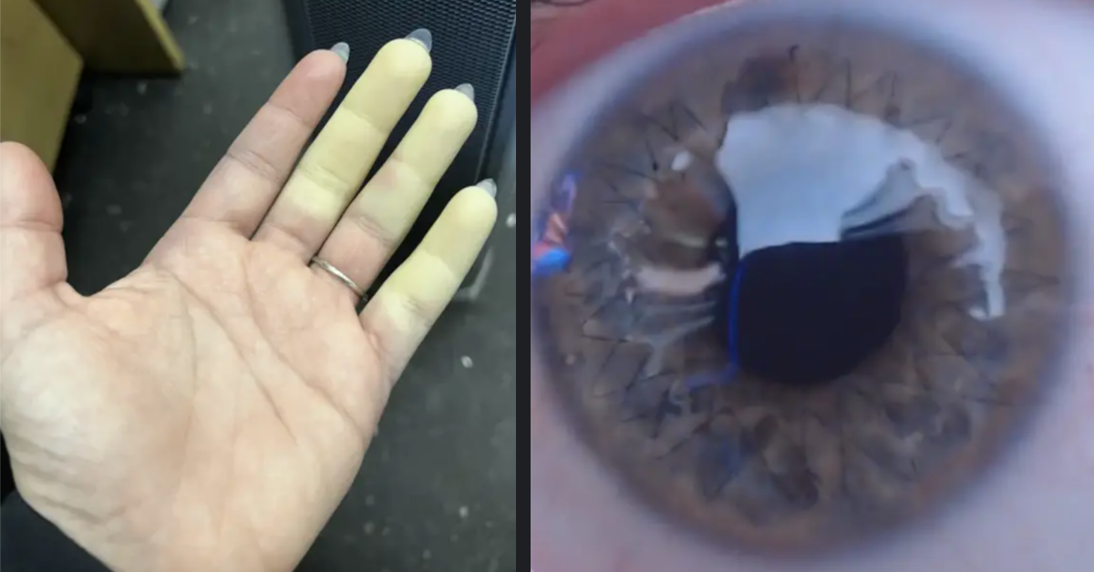 People Shared Their Interesting Body Oddities » TwistedSifter