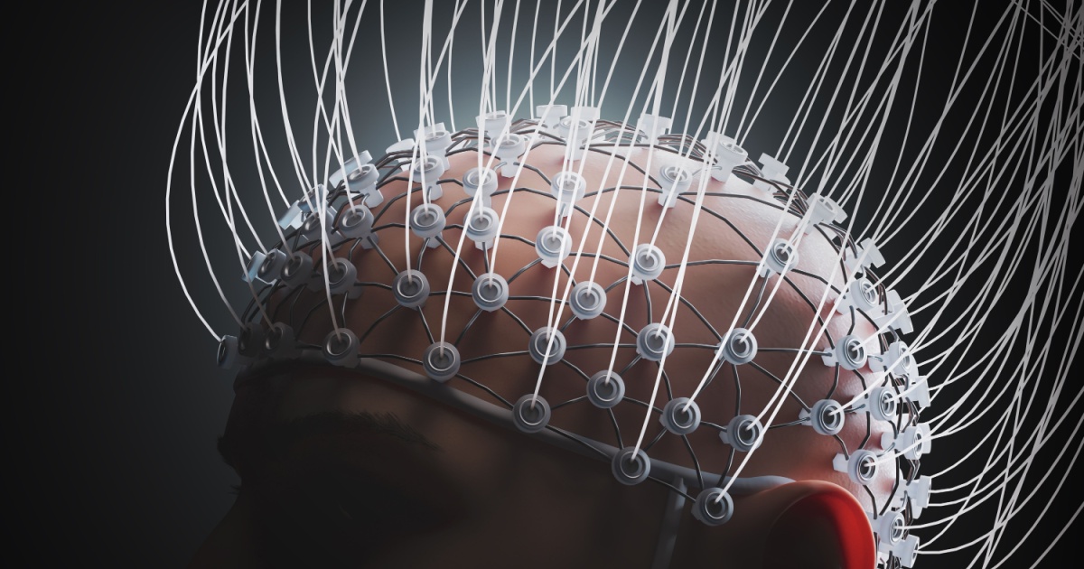 Remarkable Brain Implant Allows A Paralyzed Man To Control Someone Else ...