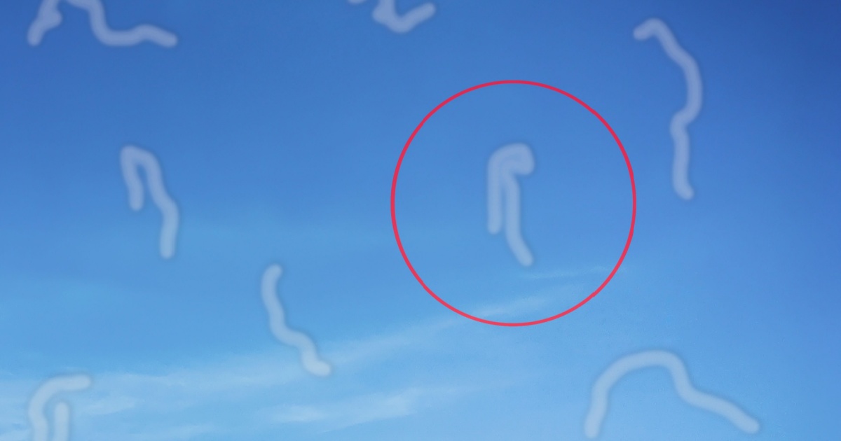 Most People Occasionally See 'Floaters' In Their Vision, But What Are ...